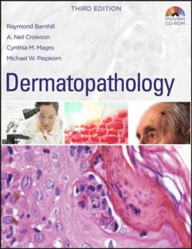 Dermatopathology: Third Edition - Ebok - Raymond L Barnhill, A Neil Crowson, Cynthia M Magro ...