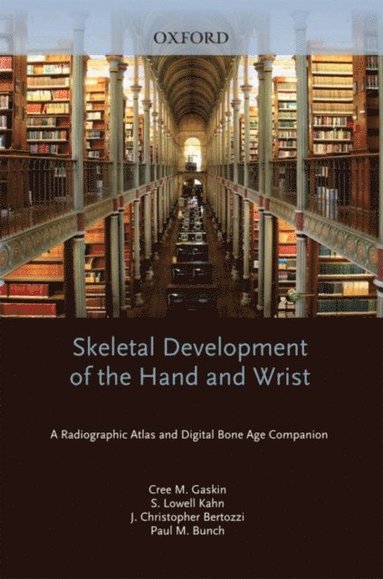 Skeletal Development of the Hand and Wrist - Ebok - Cree M Gaskin, Md ...