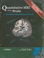Quantitative MRI of the Brain - Paul Tofts - Häftad (9780470014295) | Bokus