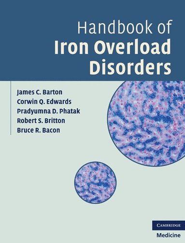 Handbook of Iron Overload Disorders - James C Barton, Corwin Q Edwards ...