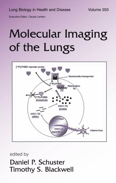 Molecular Imaging of the Lungs - Ebok - Daniel Schuster, Timothy ...