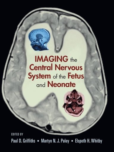 Imaging the Central Nervous System of the Fetus and Neonate - Ebok ...
