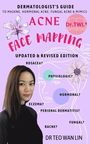 Acne Face Mapping: A Dermatologist's Specialist Module on Adult ...