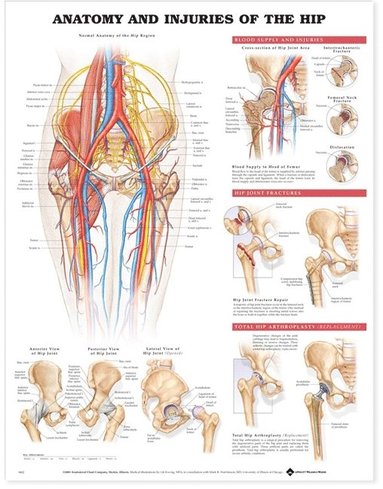 Anatomy and Injuries of the Hip Anatomical Chart - Wall Chart Laminated ...