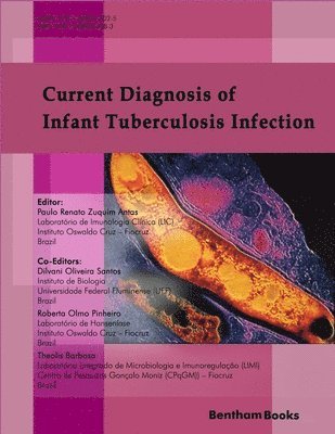 Current Diagnosis of Infant Tuberculosis Infection: , Roberta Olmo Pinheiro, - Dilvani Oliveira ...