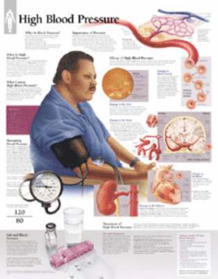 High Blood Pressure Laminated Poster - Scientific Publishing - Poster ...