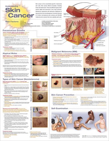 Understanding Skin Cancer Anatomical Chart - Wall Chart Laminated ...