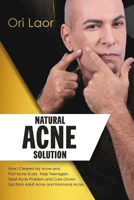 Natural Acne Solution: How I Cleared My Acne and Post Acne Scars. Help Teenagers Treat Acne ...