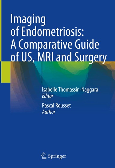 Imaging of Endometriosis: A Comparative Guide of US, MRI and Surgery ...