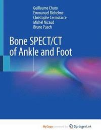 Bone SPECT/CT of Ankle and Foot - Guillaume Chuto, Emmanuel Richelme ...