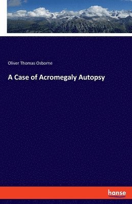 Case of Acromegaly Autopsy - Oliver Thomas Osborne - Häftad ...