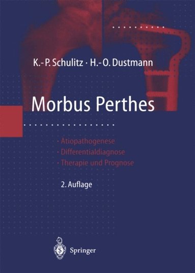 Morbus Perthes - Ebok - Klaus-Peter Schulitz, Hans-Otto Dustmann ...