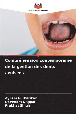 Compréhension contemporaine de la gestion des dents avulsées - Ayushi ...