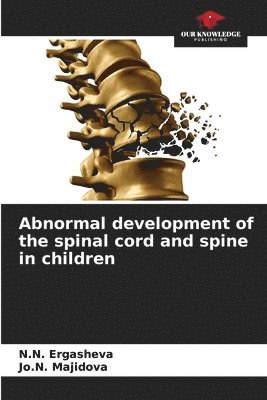 Abnormal development of the spinal cord and spine in children - N N ...