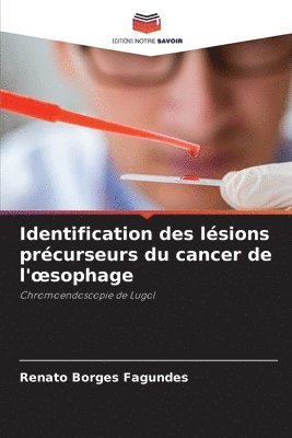 Identification des lsions prcurseurs du cancer de l'oesophage - Renato Borges Fagundes - Häftad ...