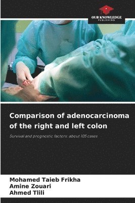 Comparison of adenocarcinoma of the right and left colon - Mohamed ...