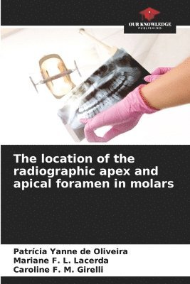 location of the radiographic apex and apical foramen in molars ...