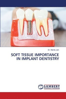 Soft Tissue Importance in Implant Dentistry - Manila Jain, Dr Manila ...