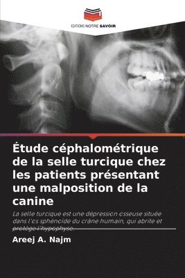 Étude céphalométrique de la selle turcique chez les patients présentant ...