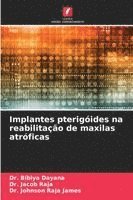 Implantes pterigóides na reabilitação de maxilas atróficas - Bibiya ...