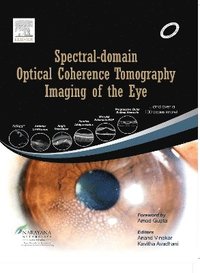 Spectral-domain Optical Coherence Tomography Imaging of the Eye - Anand Vinekar - Bok ...