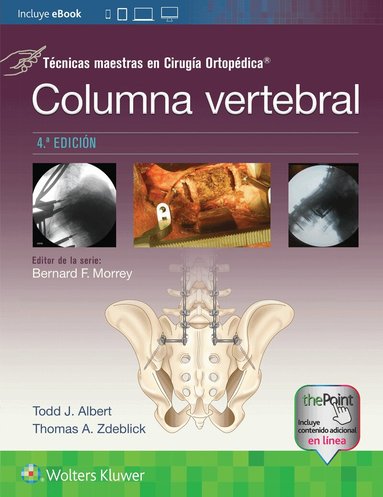 Técnicas maestras en Cirugía Ortopédica. Columna vertebral - Todd ...