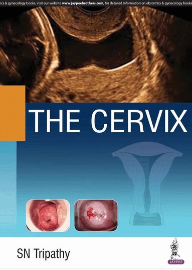 Cervix - Sn Tripathy - Bok (9789352702091) | Bokus