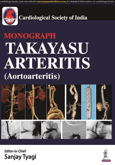 Takayasu Arteritis (Aortoarteritis) - Sanjay Tyagi, Debabrata Roy, George Joseph - Bok ...