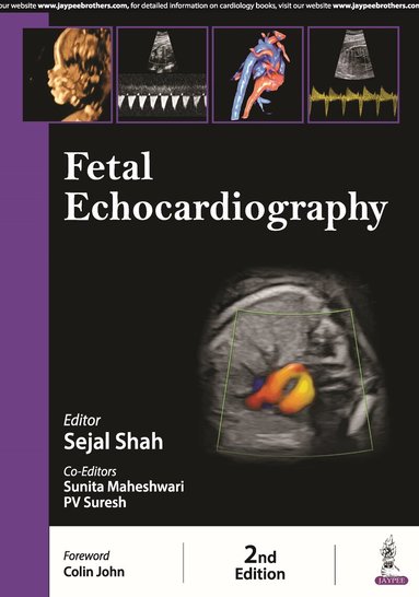 Fetal Echocardiography - Sejal Shah, Sunita Maheshwari, Pv Suresh ...