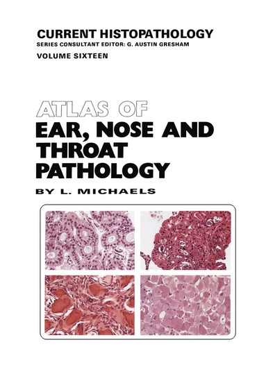 Atlas of Ear, Nose and Throat Pathology - L Michaels - Häftad ...