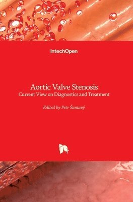 Aortic Valve Stenosis: Current View on Diagnostics and Treatment - Petr ...